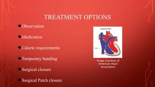 Ventricular Septal Defect | PPTX