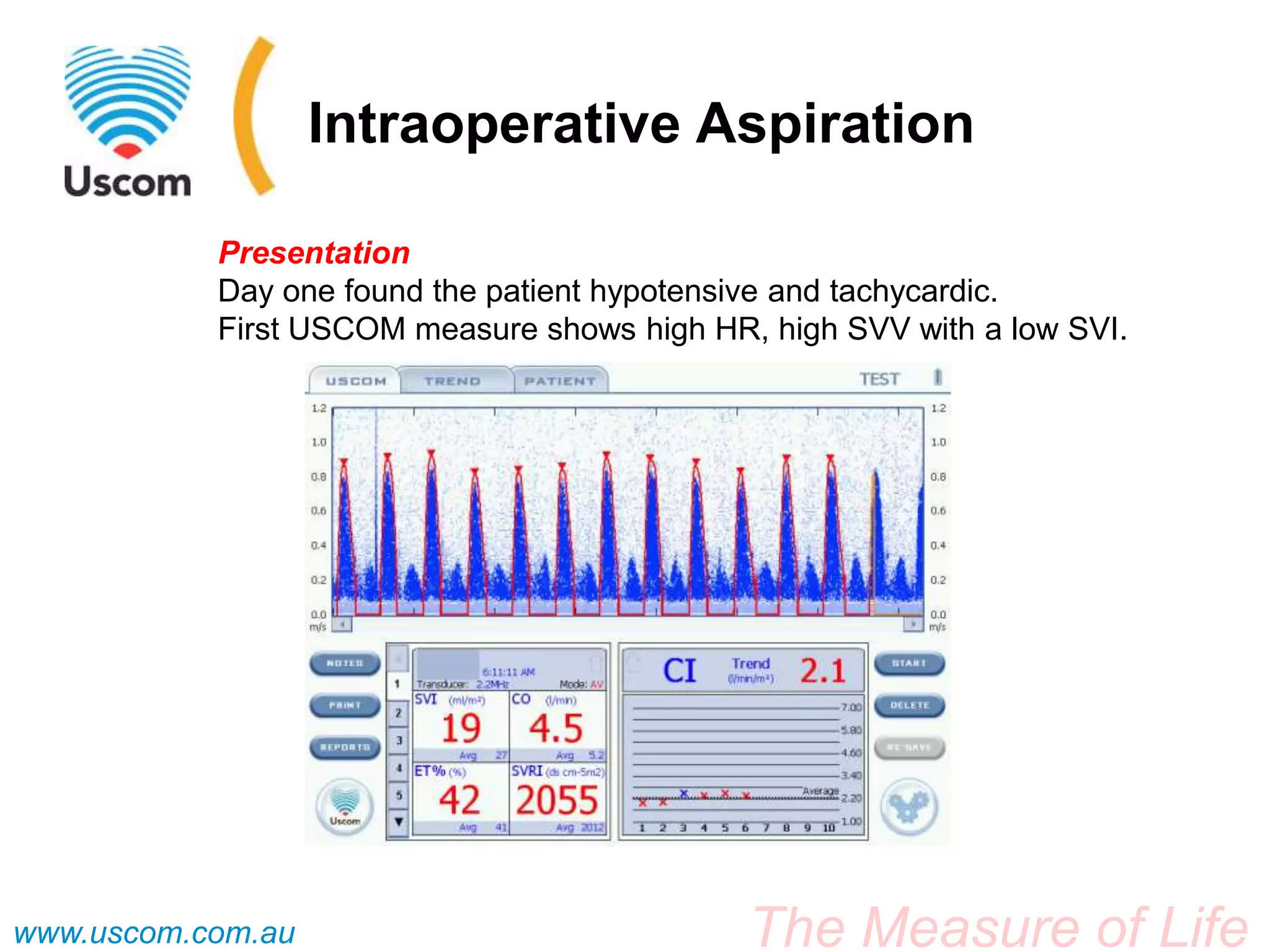Case Study - Adult - Aspiration - Septic Shock | PPTX | First Aid ...