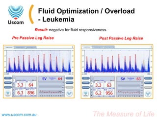 Case study - Adult - Fluid Overload - Leukemia | PPTX