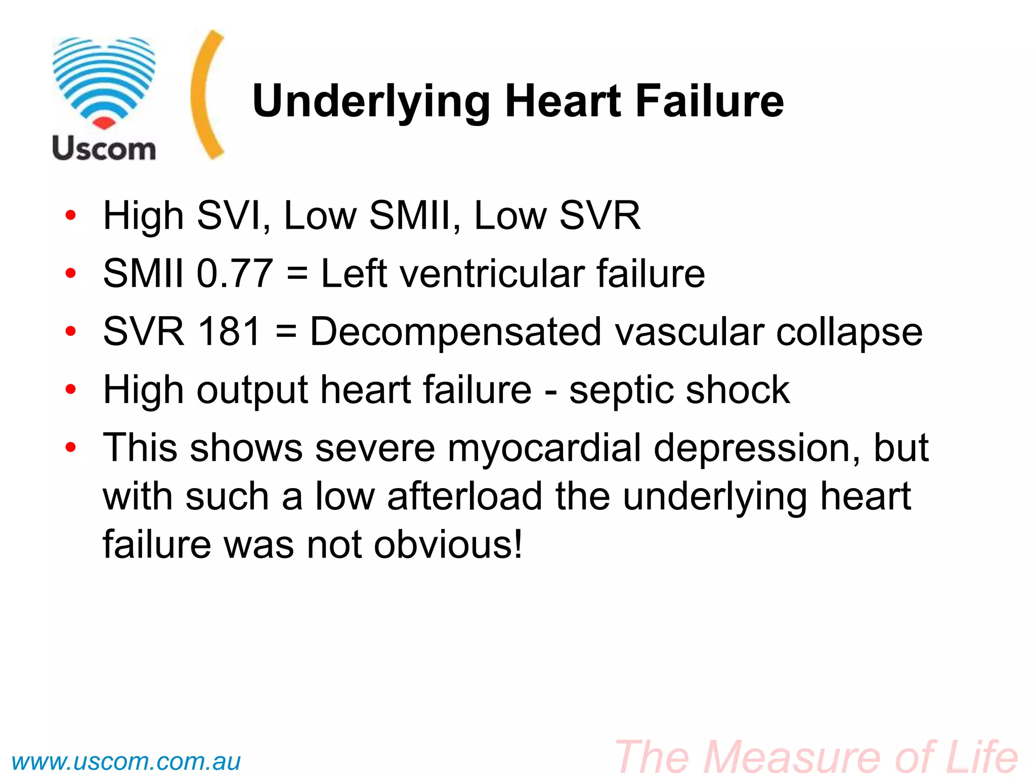 Case Study - Adult - High Output Cardiac Failure - Inotropes, Inotropy ...