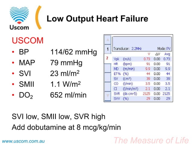 Case Study - Adult - High Output Cardiac Failure - Inotropes, Inotropy ...