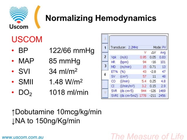 Case Study - Adult - High Output Cardiac Failure - Inotropes, Inotropy ...