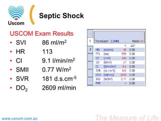 Case Study - Adult - High Output Cardiac Failure - Inotropes, Inotropy ...