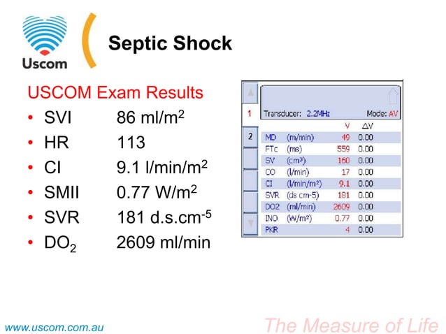 Case Study - Adult - High Output Cardiac Failure - Inotropes, Inotropy ...