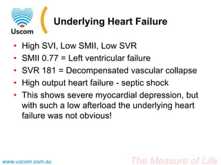 Case Study - Adult - High Output Cardiac Failure - Inotropes, Inotropy ...