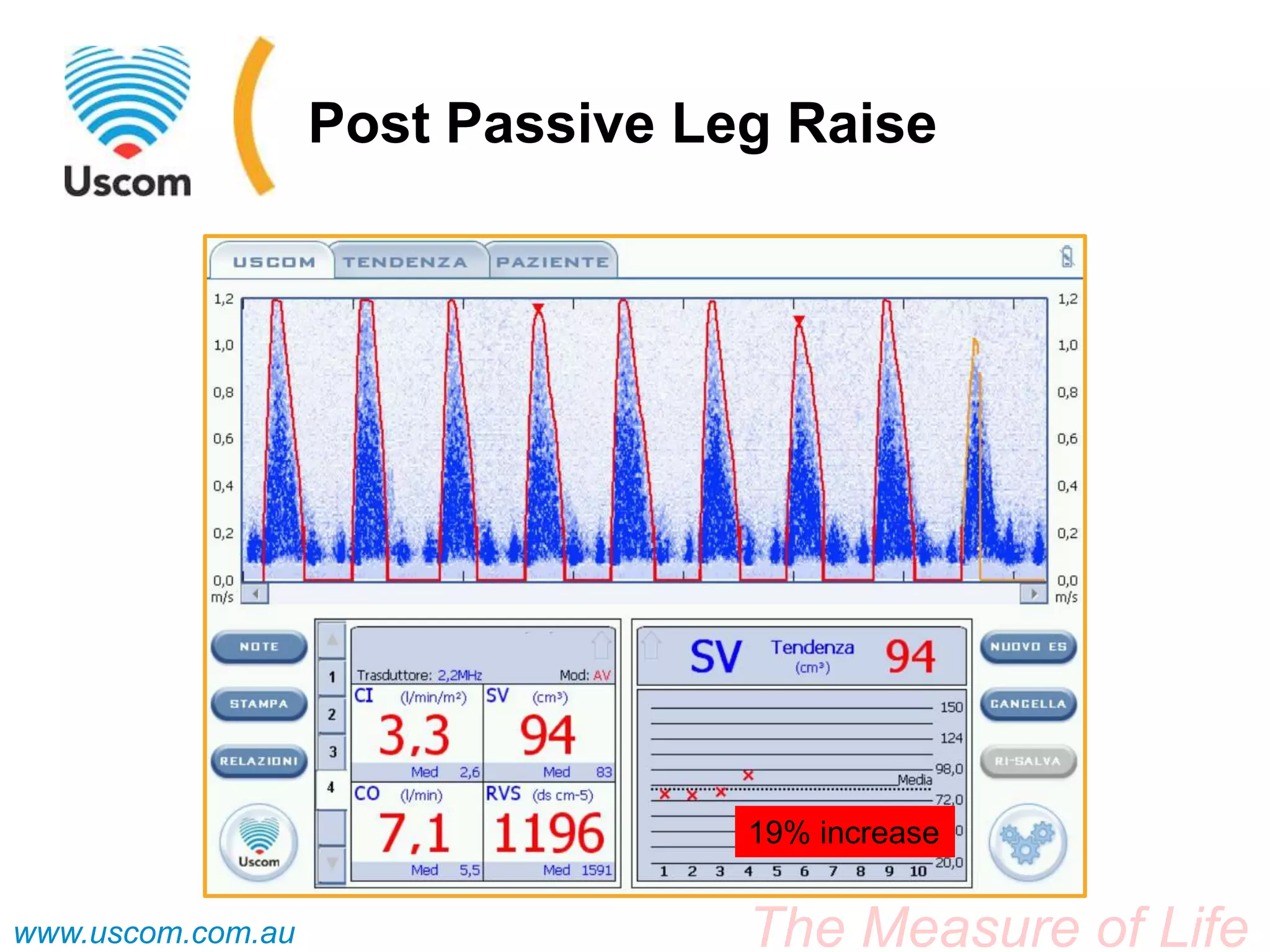 Case Study - Adult - Passive Leg Raise | PPTX