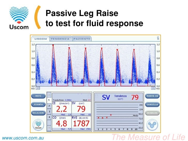 Case Study - Adult - Passive Leg Raise