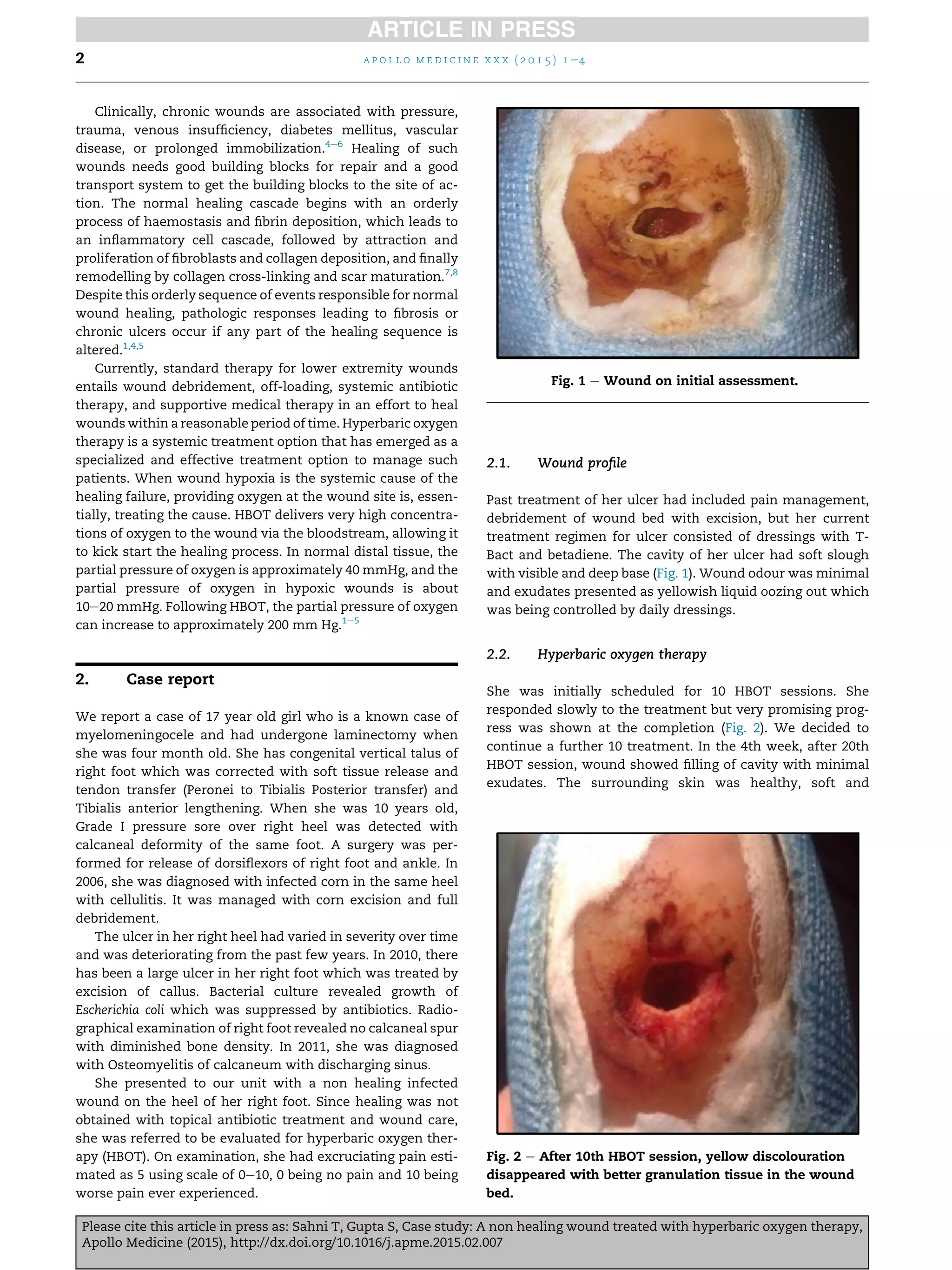 Case study: A non healing wound treated with hyperbaric oxygen therapy ...