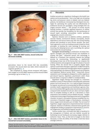 Case study: A non healing wound treated with hyperbaric oxygen therapy ...