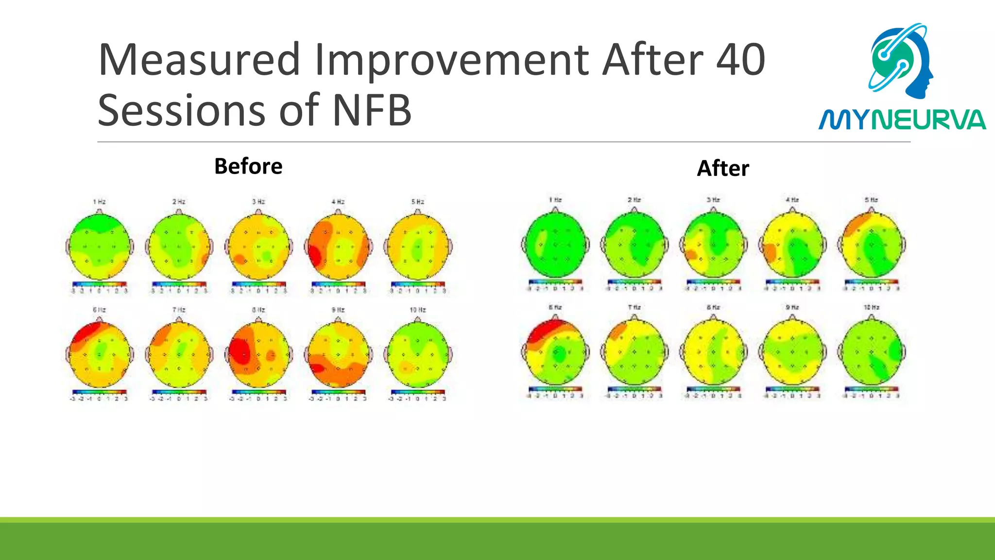 Case study autism (asd) | PPTX