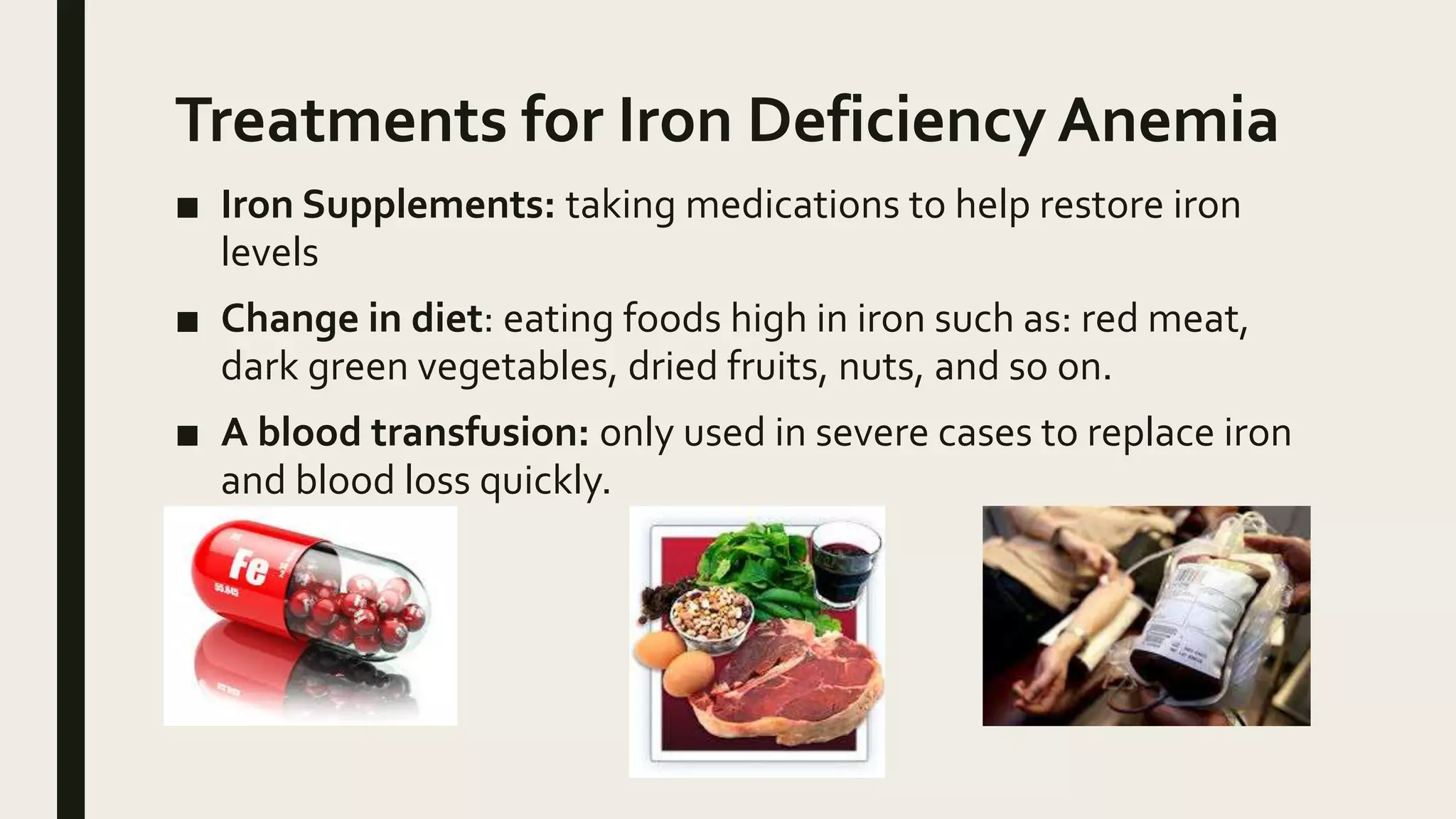 Case Study - Iron Deficiency Anemia | PPTX