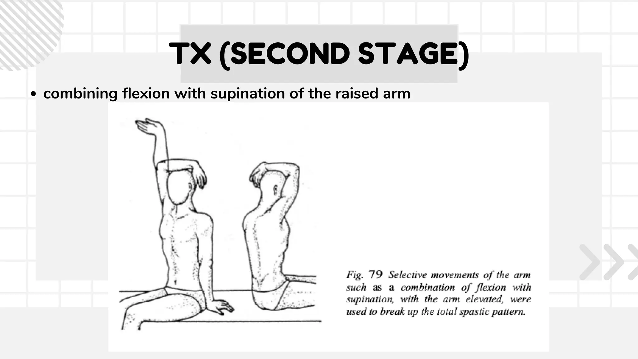 CASE STUDY (Bobath approach therapy).pdf
