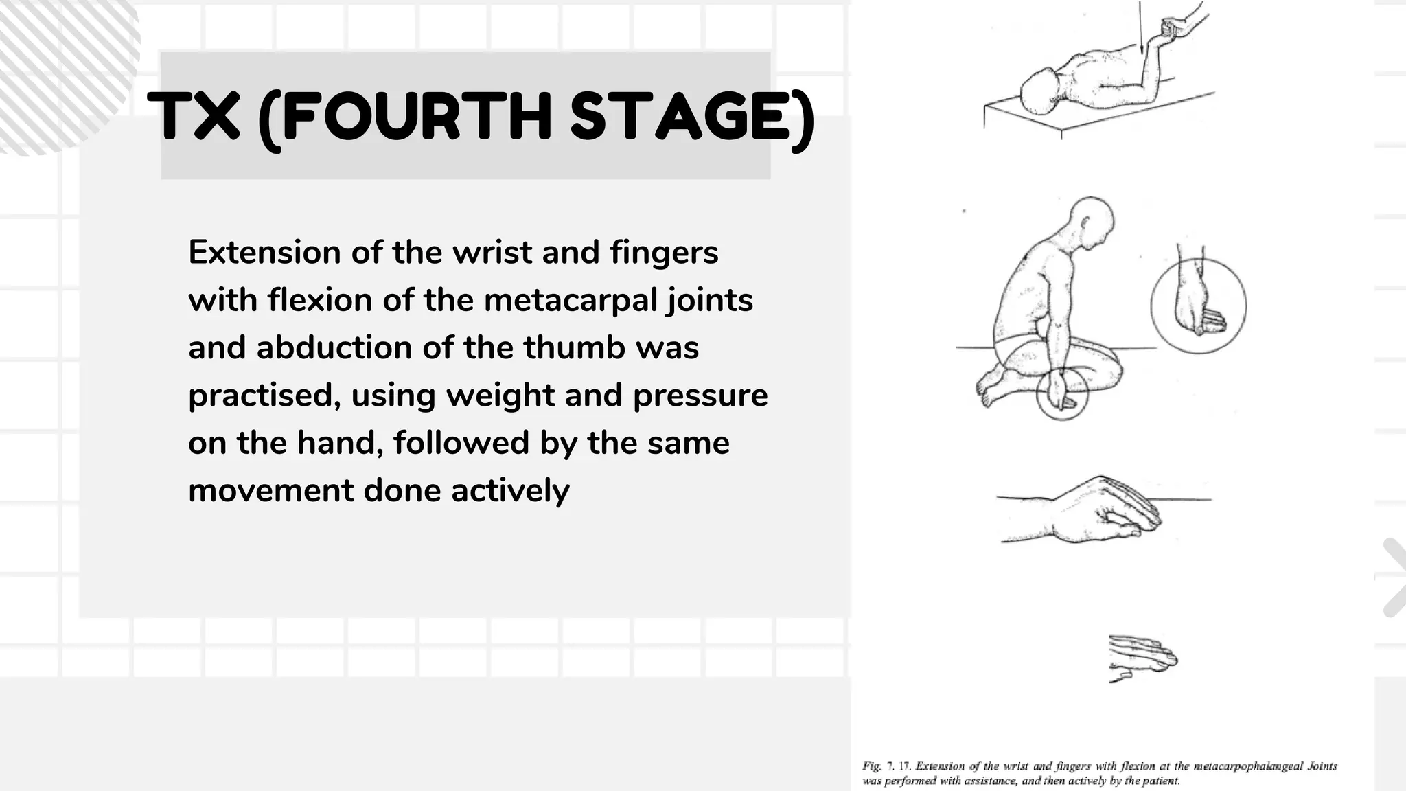 CASE STUDY (Bobath approach therapy).pdf