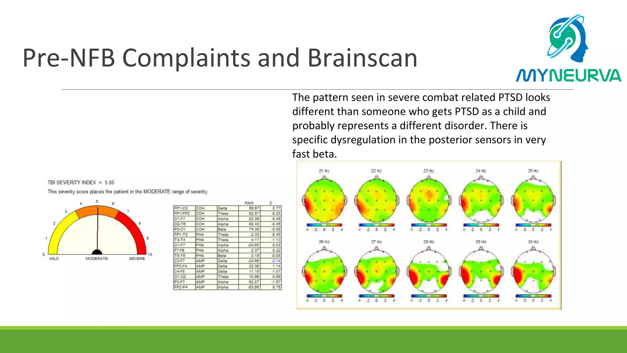 Case study combat related ptsd | PPTX