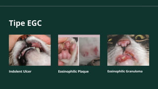 Case Study Eosinophilic Granulomatous Complex | PPT