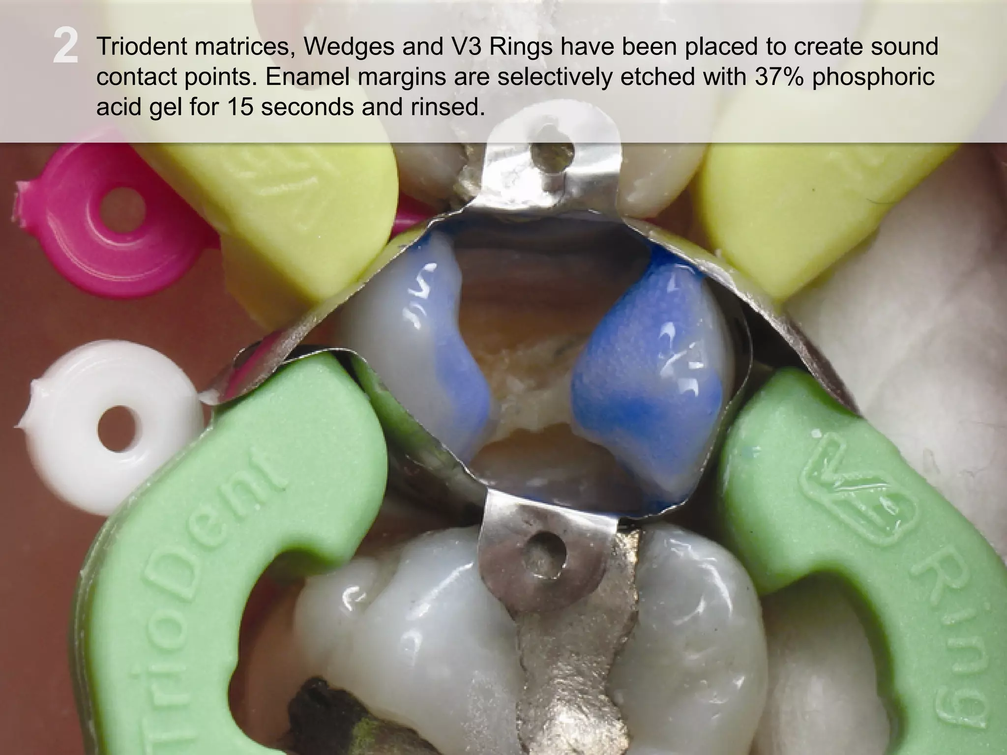 Contact Points by Dr Graeme Milicich | PPTX