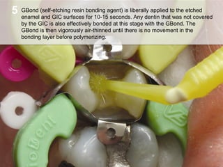 Contact Points by Dr Graeme Milicich | PPTX