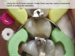 Contact Points by Dr Graeme Milicich | PPTX