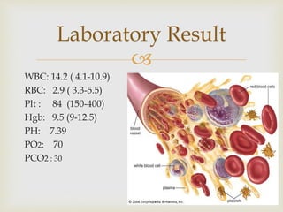 Case study HIV | PPTX