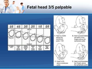 CASE STUDY OF ECLAMPSIA.ppt | Pregnancy | Reproductive Health