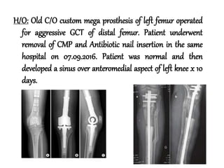 Case study on antibiotic coated nail infection in | PPT | Free Download
