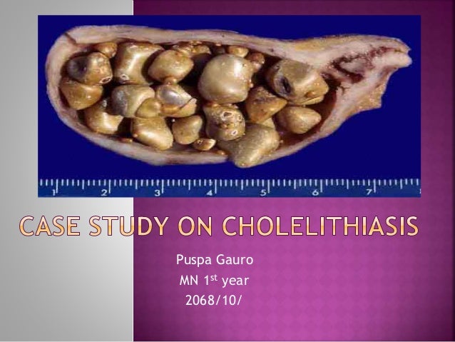 Case study on cholelithiasis