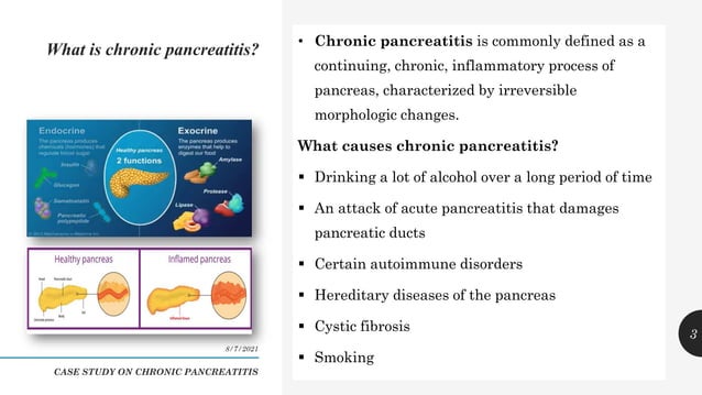 Case study on chronic pancreatitis | PPT