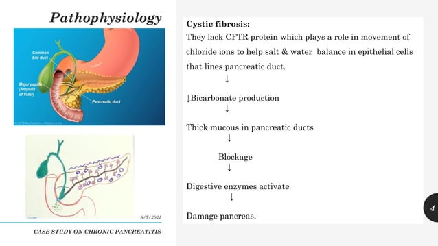 Case study on chronic pancreatitis | PPT