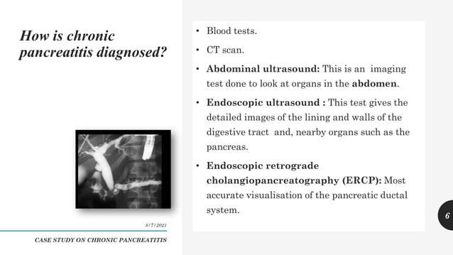 Case study on chronic pancreatitis | PPT