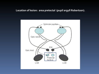 CASE STUDY ON CLINICAL NEUROANATOMY | PPT