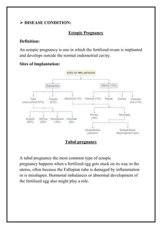 Case Study On Ectopic Pregnancy..pdf.... | PDF