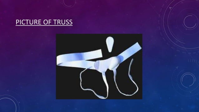 Case study on inguinal hernia | PPTX