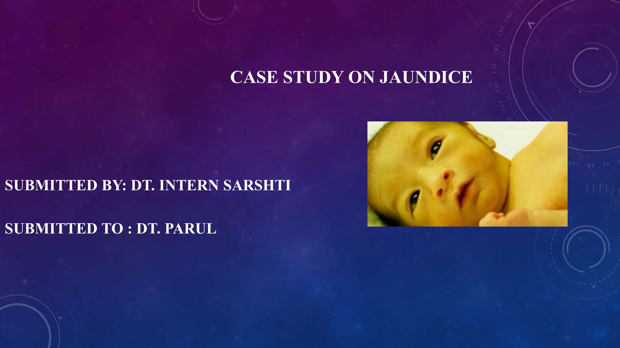 CASE STUDY ON JAUNDICE - Copy.pptx