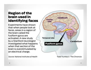 Fusiform Gyrus Prosopagnosia