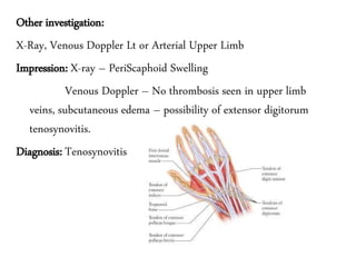 Case study on tenosynovitis | PPTX