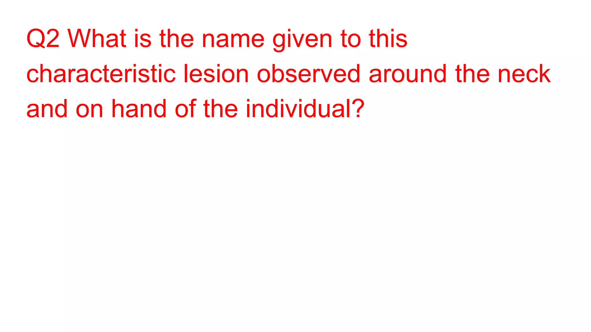Case study Pallegra-3.pptx