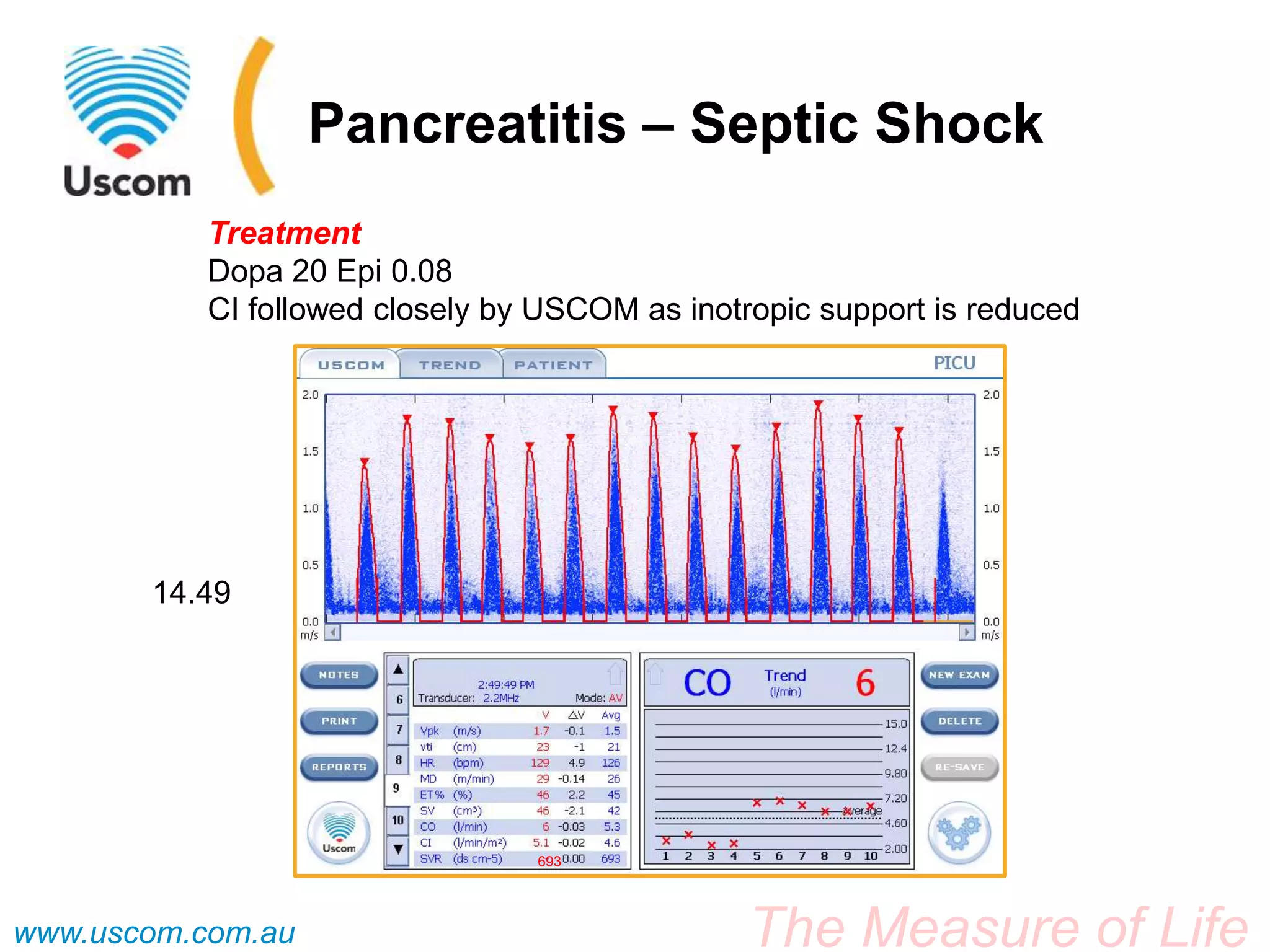 Case Study - Pediatric - Pancreatitis - Septic Shock | PPTX