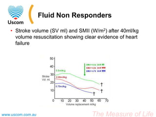Case Study - Pediatric - Septic Shock - Fluid Responsiveness and SMII ...