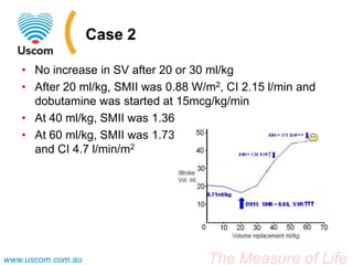 Case Study - Pediatric - Septic Shock - Fluid Responsiveness and SMII ...