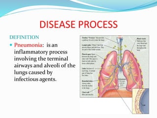 Case study pn | PPTX