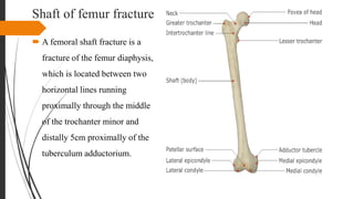 shaft of femur fracture | PDF