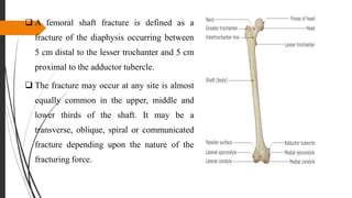 shaft of femur fracture | PDF