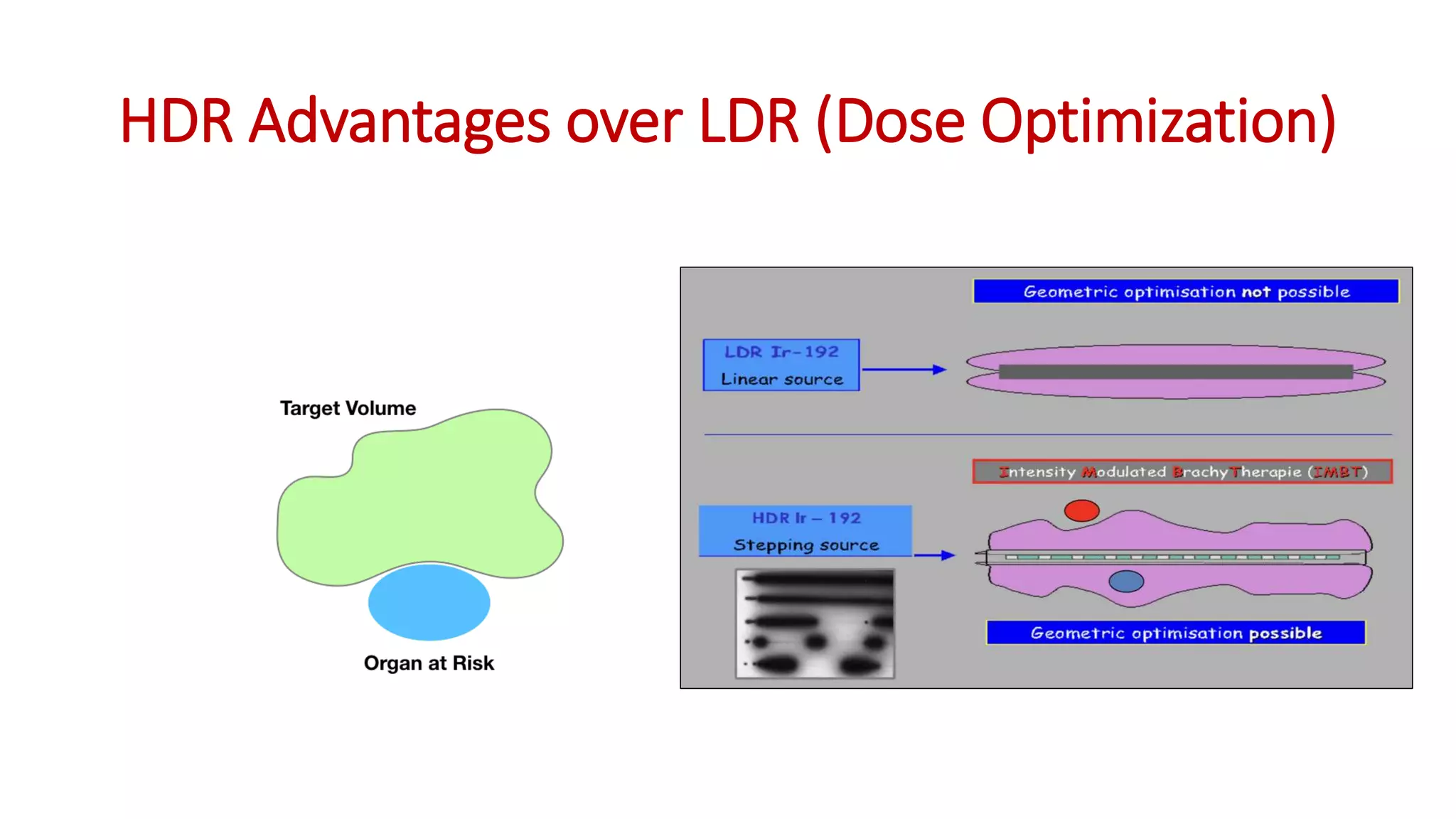 Case Study: Low Risk Prostate Cancer | PPTX