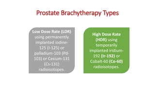 Case Study: Low Risk Prostate Cancer | PPT