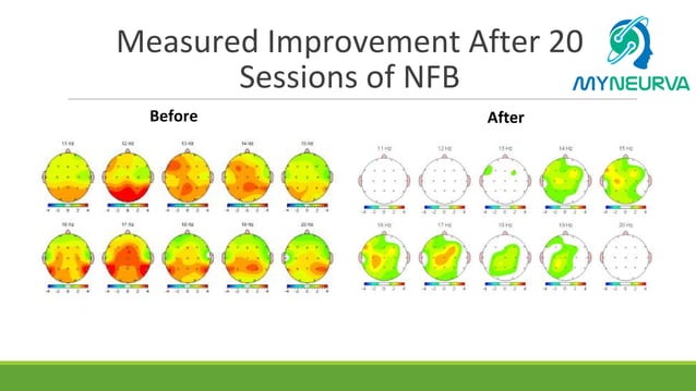 Case study ptsd (1) | PPTX