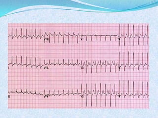Case study svt | PPTX