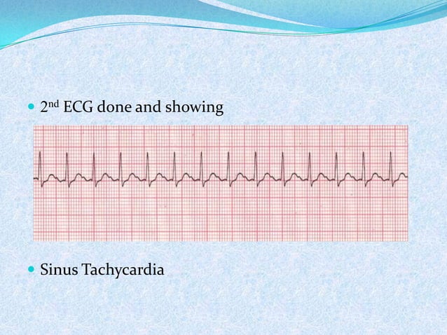 Case study svt | PPTX