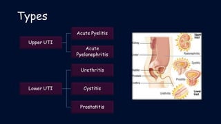 Case study of urinary tract infection | PPT