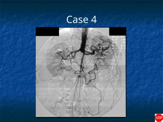 cases_vascular.pptx Radiology Reporting Sample | PPTX