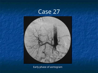 Cases vascular 2 Radiology Reporting Sample | PPTX